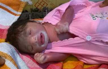 दर्द से तिलमिलाती है 'प्लास्टिक की गुडिय़ा'