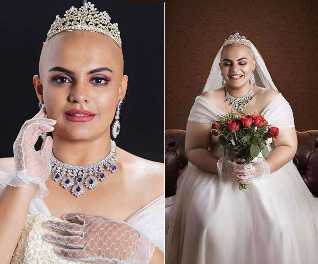 Bald Bold Bride: इस मॉडल ने लिया सिर मुंडवाने का बड़ा फैसला, वजह जान ...