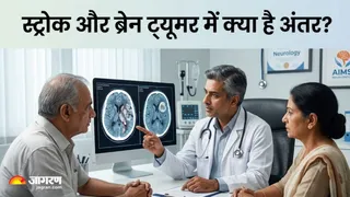 स्ट्रोक है या ब्रेन ट्यूमर? मिलते-जुलते लक्षणों का फर्क पहचानना है ...