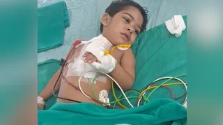 गाजियाबाद के डॉक्टरों ने किया कमाल, डेढ़ साल के बच्चे की हार्ट सर्जरी ...