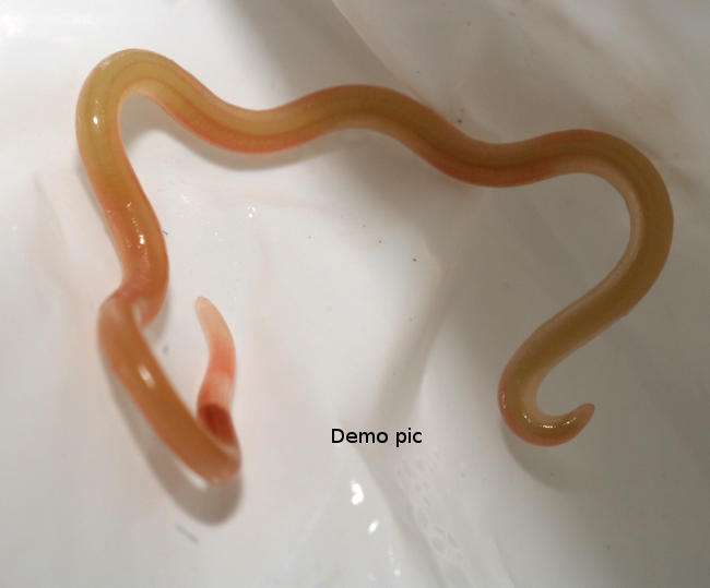 इस औरत के चेहरे पर था कीड़ा और उसे पता ही नहीं