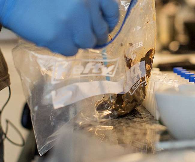 स्टूल प्रत्यारोपण से हो सकता है एल्‍कोहोलिक हेपेटाइटिस रोगियों का इलाज