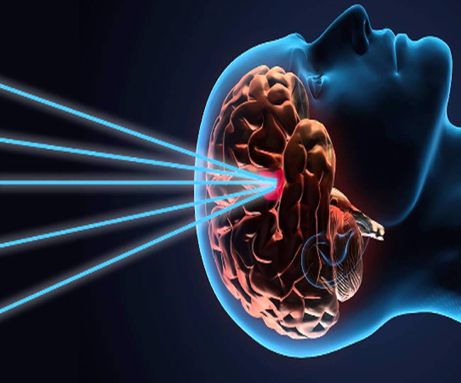 ब्रेन ट्यूमर वाले मरीजों के लिए एक बार गामा थैरेपी के बारे में जानना भी ...