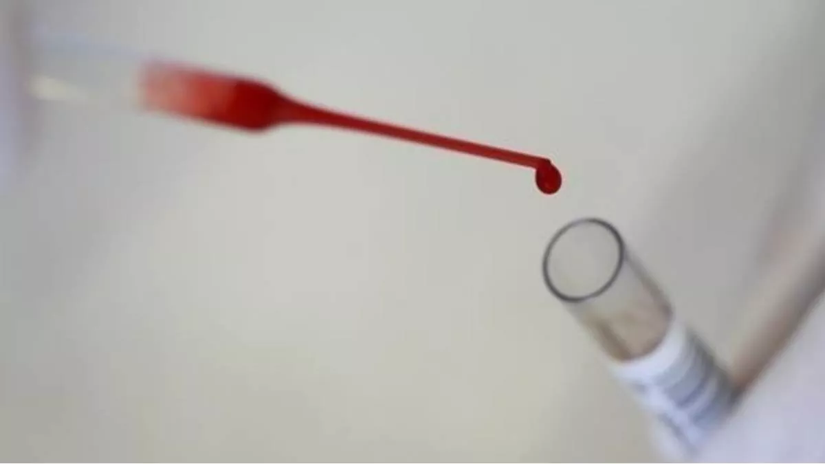 मल्टी कैंसर अर्ली डिटेक्शन ब्लड टेस्ट के जरिए आसानी से हो सकती है कैंसर ...