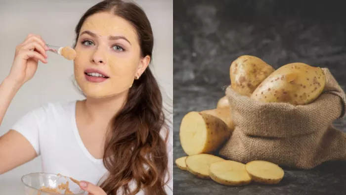 चेहरे पर इस तरह लगा लें कच्चा आलू, दाग-धब्बे हो जाएंगे साफ, मिलेगी ...