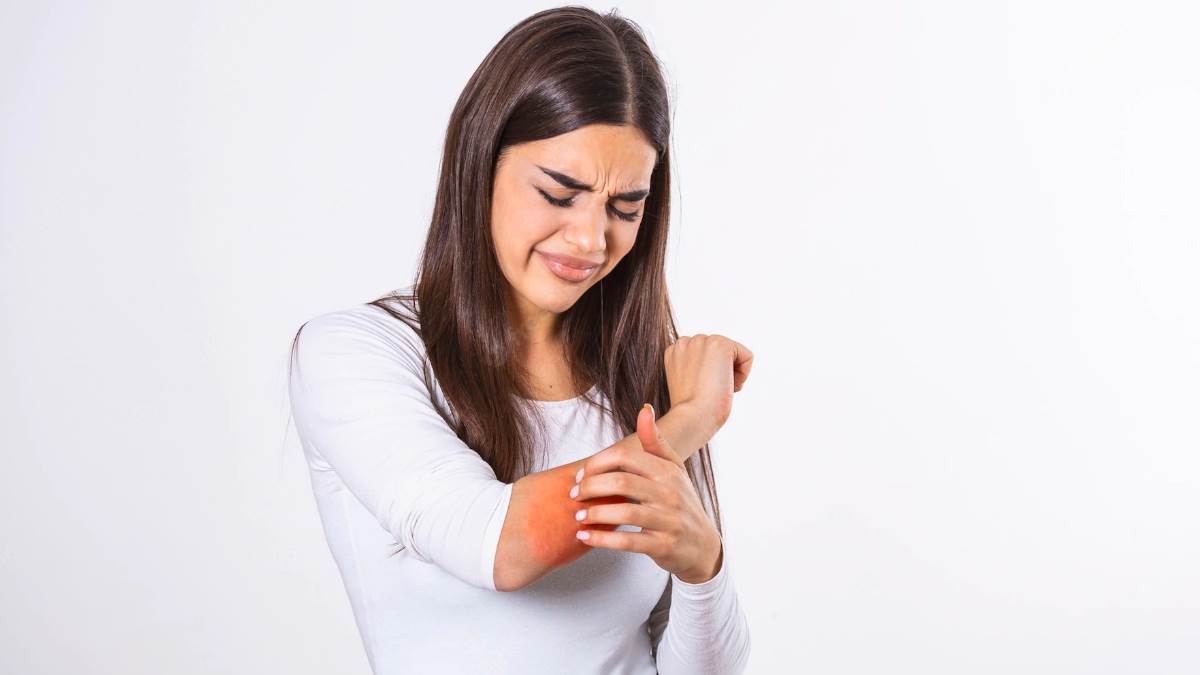 Ringworms Home Remedies ringworms-home-remedies
