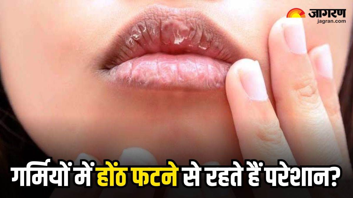 Dry Lips dry-lips