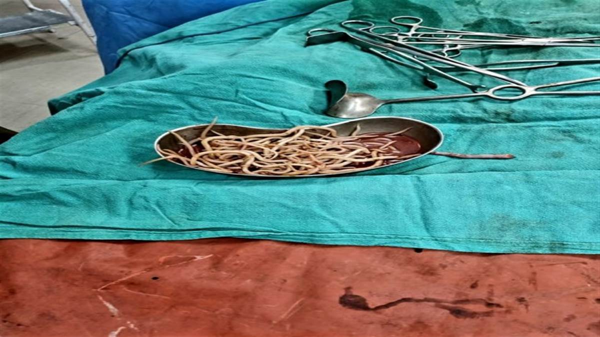 Jammu Kashmir : जिला अस्पताल पुंछ में छह साल के बच्चे की आंतों से निकले ...
