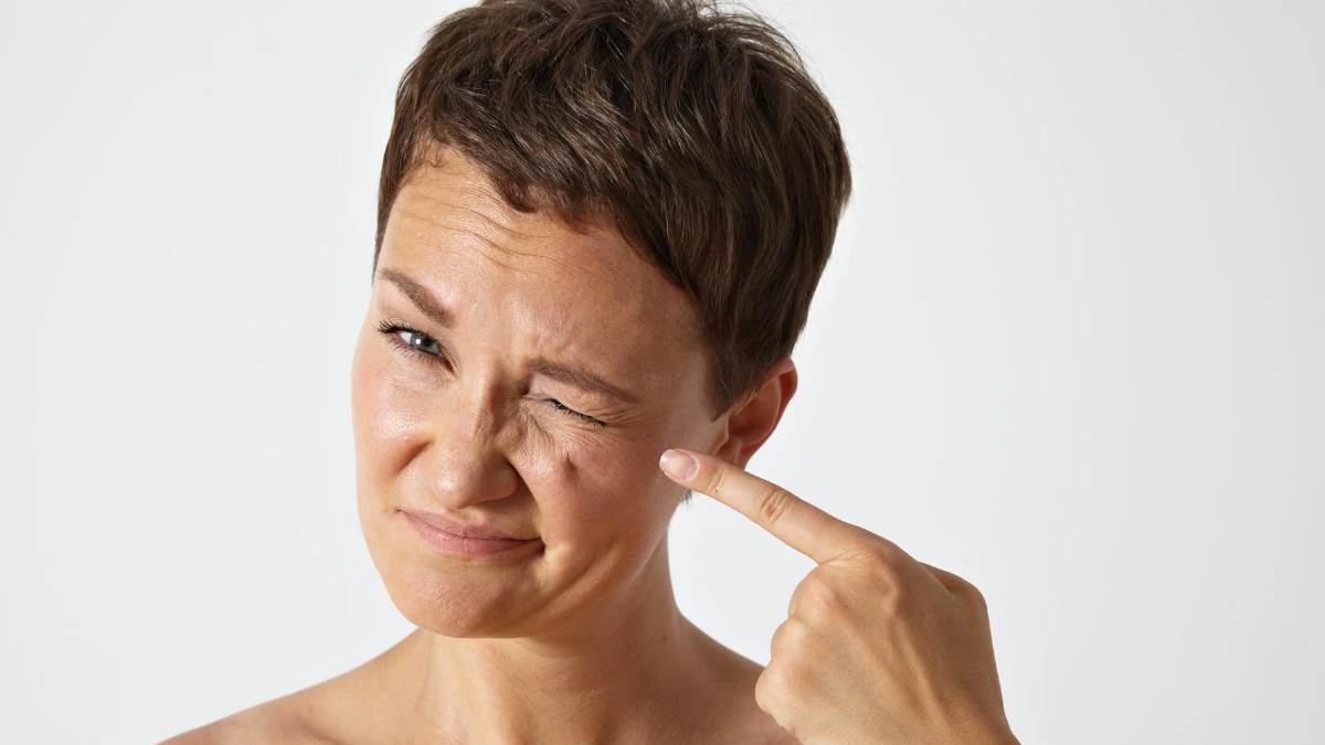 Crows feet Remedies: आंखों की झुर्रियों से बचाव के लिए अपनाएं ये आसान ...