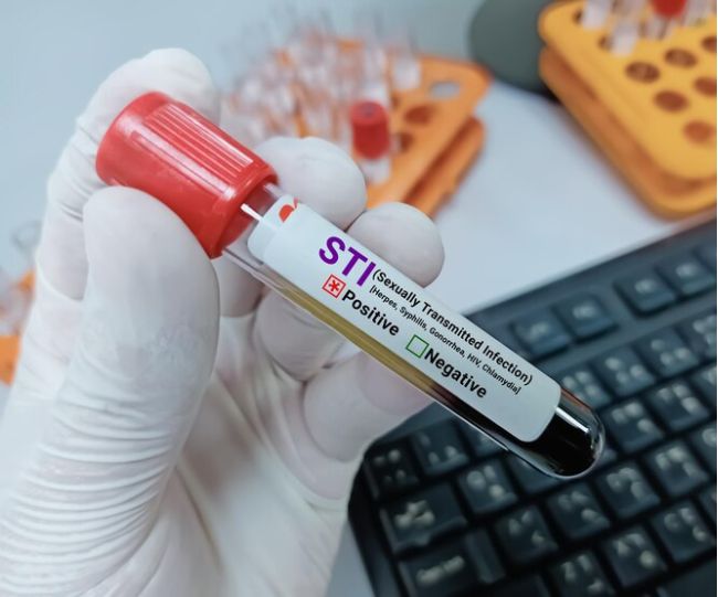 सेक्शुअली एक्टिव हैं, तो जरूर कराएं ये STI Tests, वरना जानलेवा साबित हो ...