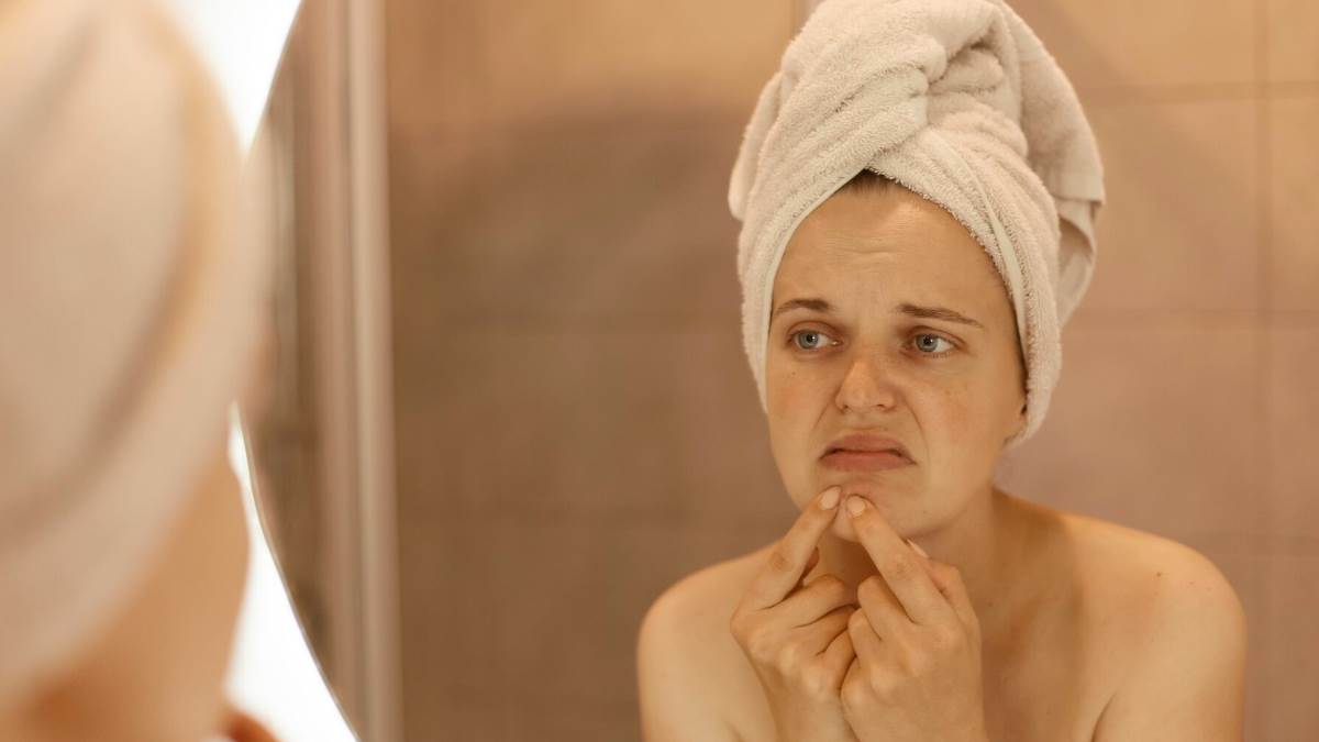 Remedies For Dark Spots remedies-for-dark-spots