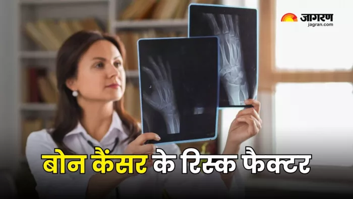 Bone Cancer Awareness Month: डॉक्टर से जानें किन वजहों से बढ़ जाता है ...
