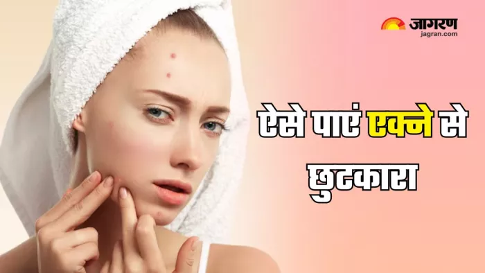 Curd and Alum Face Pack: आए दिन हो जाते हैं एक्ने, तो दही और फिटकरी का ...