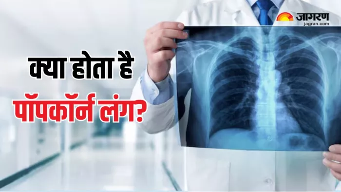 सिर्फ वेपिंग की वजह से ही होता है Popcorn Lung? जानें इसके लक्षण, कारण ...