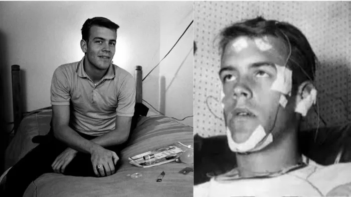 दोस्तों से शर्त लगाकर 11 दिनों तक नहीं सोया यह शख्स, फिर जो हुआ; उसने ...