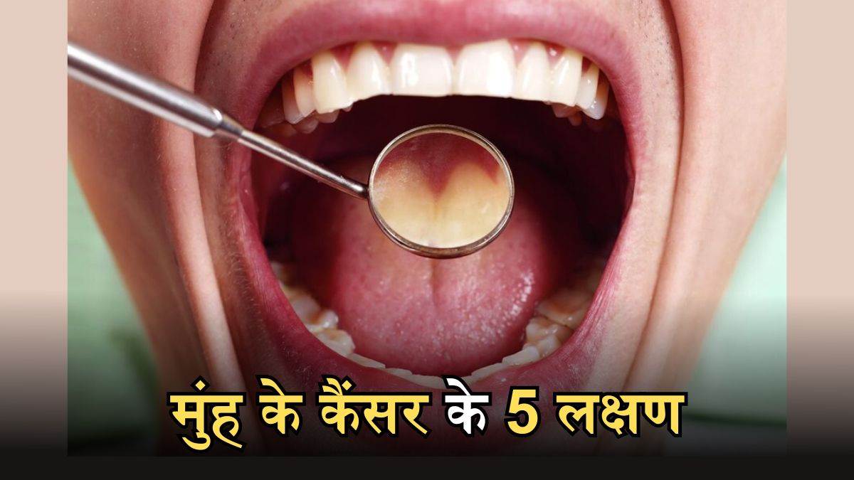 Mouth Cancer Early Symptoms In Hindi - Infoupdate.org