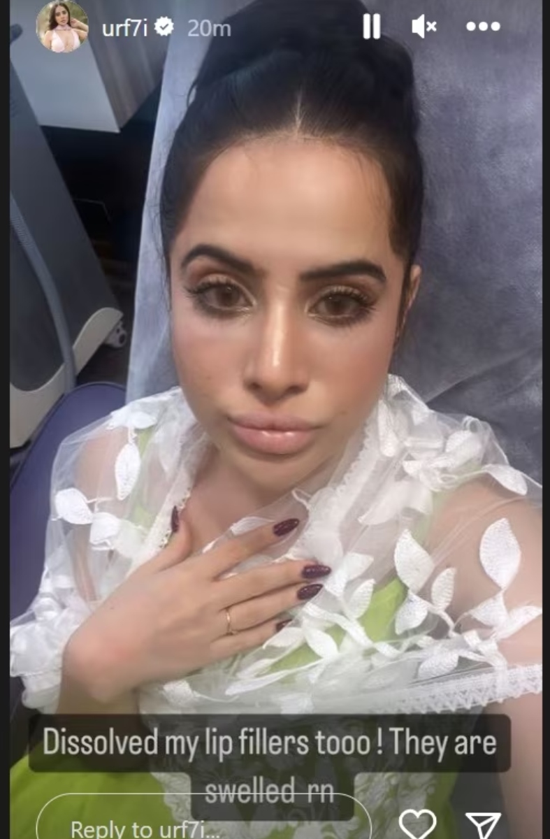 Urfi Javed Post: अंडर आई फिलर से उर्फी जावेद का बिगड़ा चेहरा, बोली ...