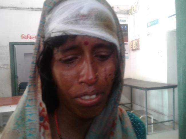 पत्नी ने मायके से पैसा व राशन नहीं लाई तो फोड़ दिया सिर