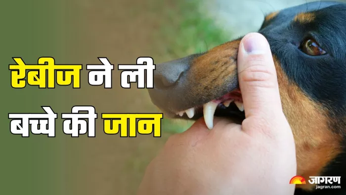 तमिलनाडु में Rabies ने ली चार साल के बच्चे की जान, डॉक्टर ने बताया कैसे ...