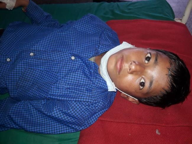 गलघोटू से दो बच्चे और संक्रमित - Two children infected with the disease ...