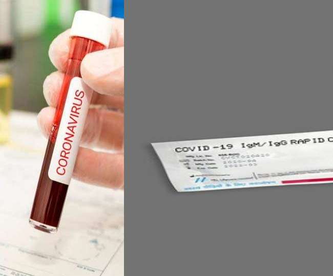 Coronavirus Kit Scam: नामी कंपनी पर खराब गुणवत्ता की 15 लाख कोरोना ...