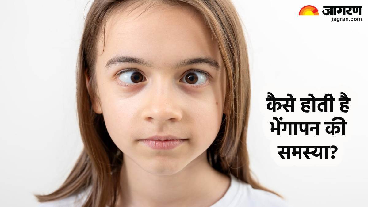 एक्सपर्ट से जानें क्या है Squint Eye प्रॉब्लम और इसमें मरीज को किस तरह ...