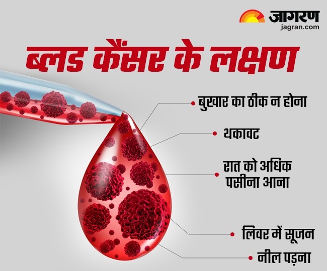 Blood Cancer: एक नहीं कई प्रकार का होता है ब्लड कैंसर, एक्सपर्ट से ...