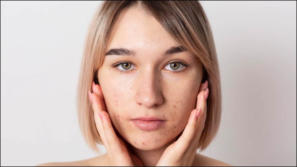 Skin Care Tips: चेहरे की झाइयां छीन रही हैं आपकी खूबसूरती, तो इन 5 ...