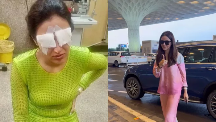 कॉर्निया डैमेज होने के बाद पहली बार मीडिया के सामने आईं Jasmin Bhasin ...