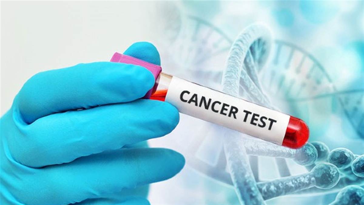 Cancer Test : रक्त के नमूने से होगी कैंसर की जांच, 8000 रुपये में हो ...