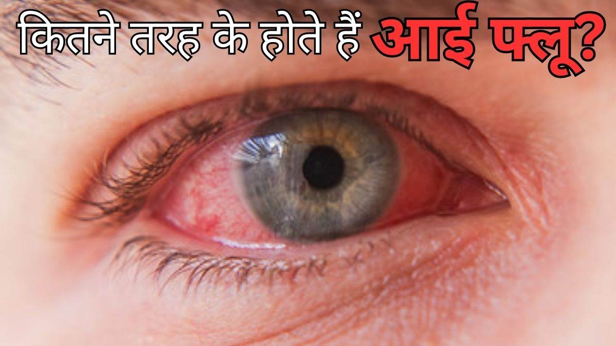 Eye Flu: एक ही तरह का नहीं होता 'आई फ्लू', एक्सपर्ट से जानें कौन-सा है सबसे खतरनाक - what is Eye ...