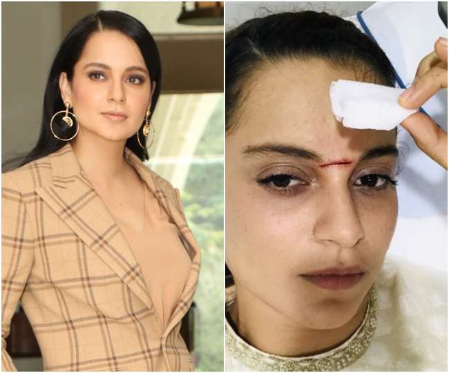 Kangana Ranaut के सिर पर असली तलवार से लगी चोट, जानें- किसने किया था ...