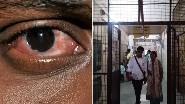 Eye Flu: दिल्ली-NCR समेत उत्तर भारत में क्यों फैल रहा आई फ्लू, एम्स के डॉक्टरों ने बताई वजह ...