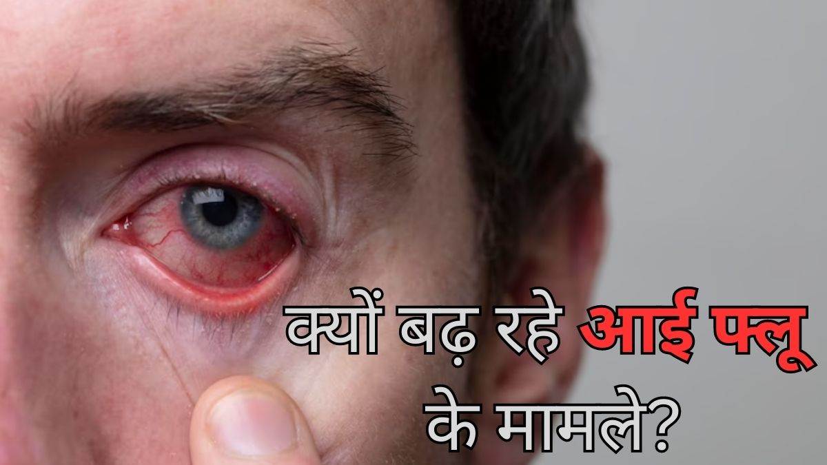 Eye Flu: देश में अचानक क्यों बढ़ने लगे हैं आई फ्लू के मामले, एक्सपर्ट ...
