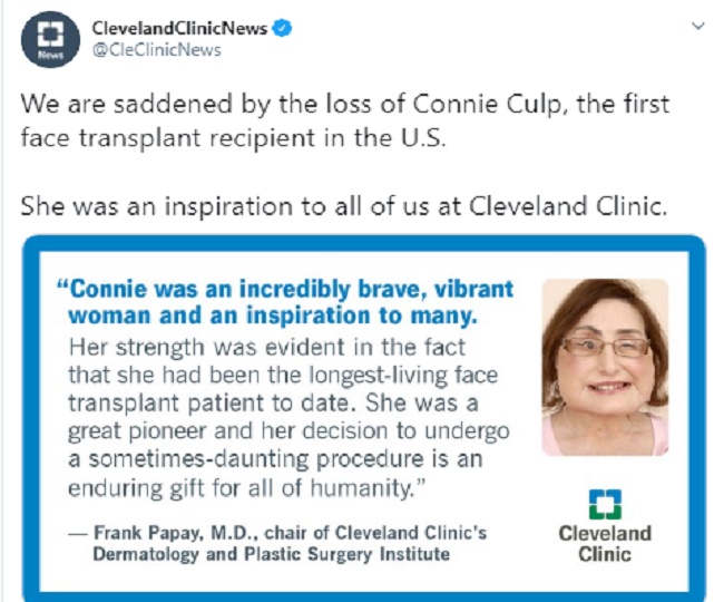 Connie Culp Death:अमेरिका में फेस ट्रांसप्लांट कराने वाली पहली महिला की ...